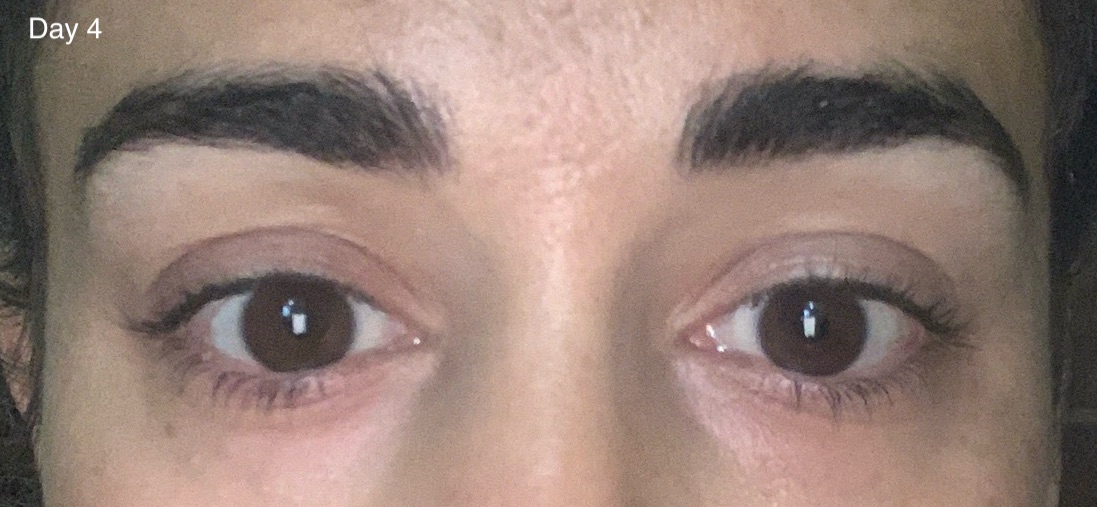Microblading: Photos of the Day by Day Healing Process - alex izzo